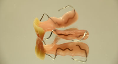 Prothese:Interimsprothese | Dental Studio Feindler GmbH