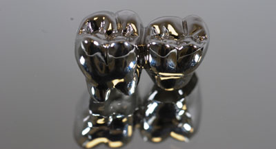 Krone:Vollguss | Dental Studio Feindler GmbH