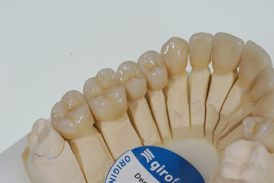 Krone:Zirkon | Dental Studio Feindler GmbH